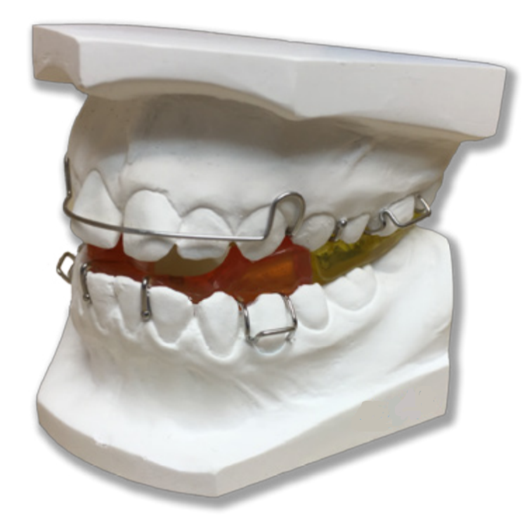 Orthodontics — s4s london