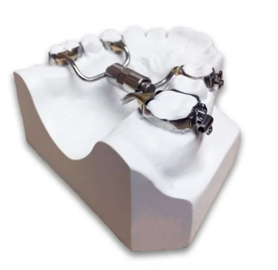 Orthodontics — s4s london