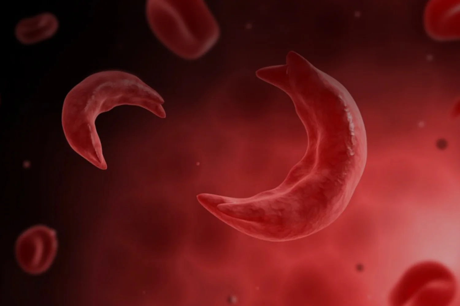 The Sickle Cell Project — Faith Thomas Foundation