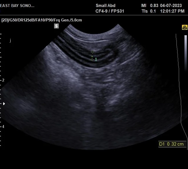Inflammatory Bowel Disease in Cats — SCRIPTWORKS