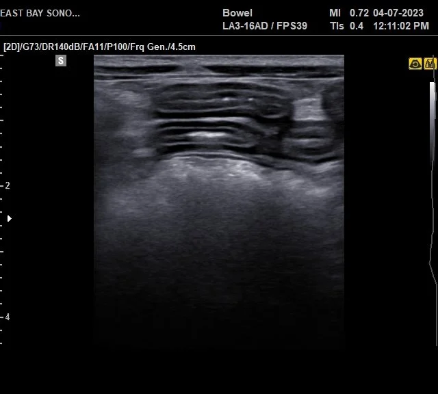 Inflammatory Bowel Disease in Cats — SCRIPTWORKS