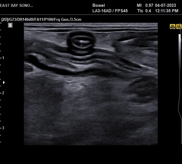 Inflammatory Bowel Disease in Cats — SCRIPTWORKS