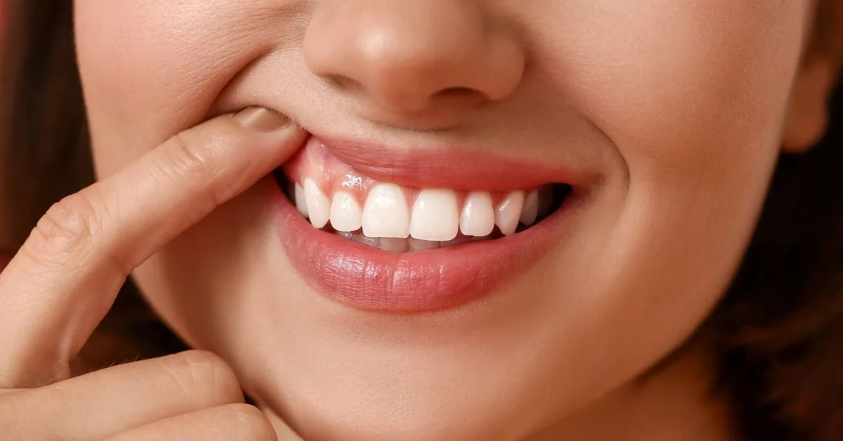 Dental Health: The Perio Protect Method for Periodontal Disease - Bay ...