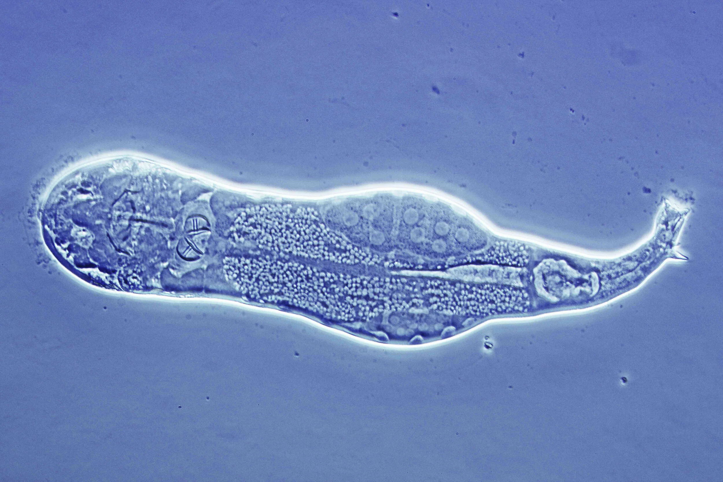 Rotifer Under A Microscope