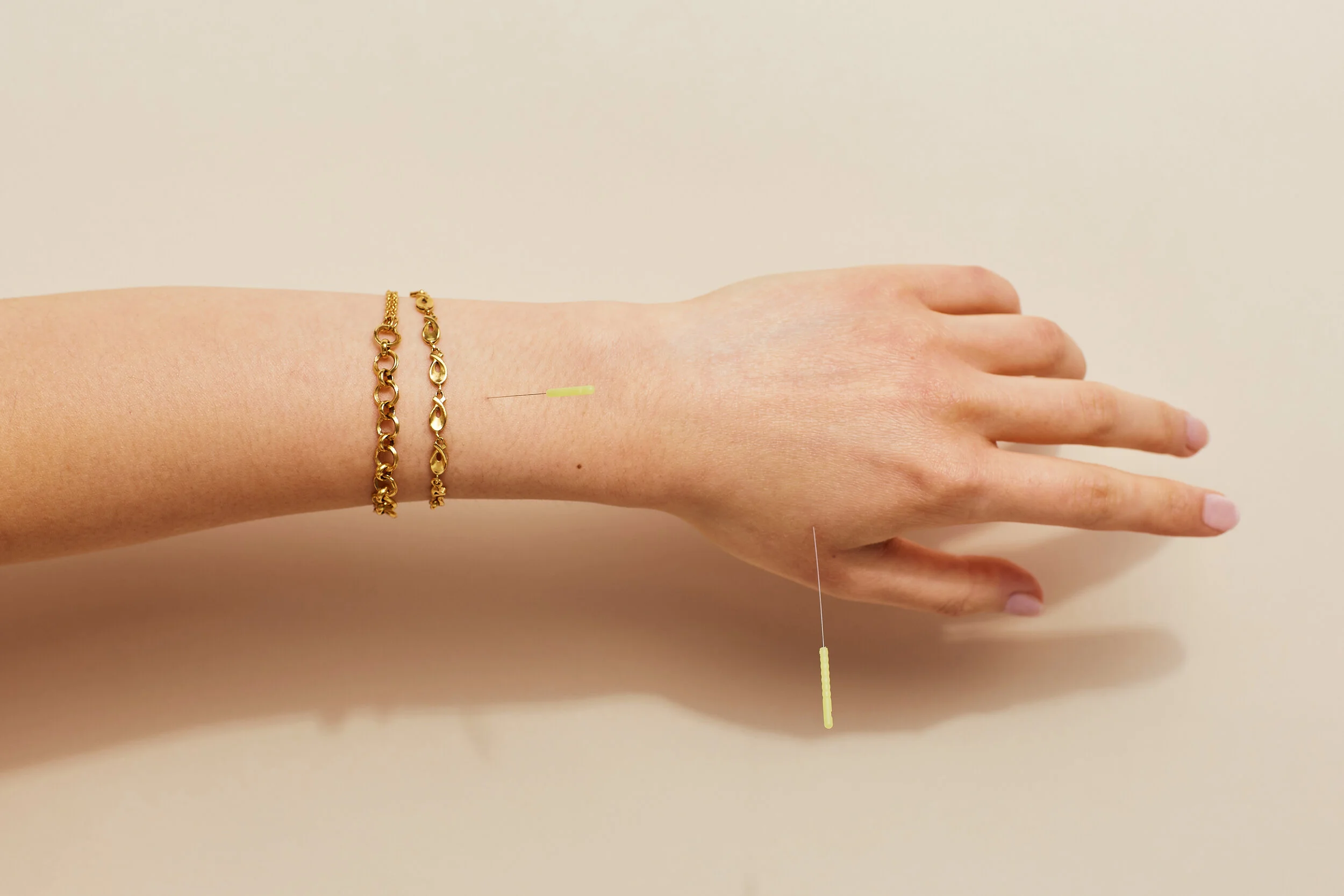 Acupuncture Services — Curator Wellness