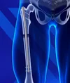 Height Surgery Approach | LimbplastX Institute