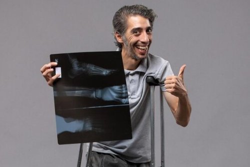 Precice Max (Pmax) | LimbplastX Institute