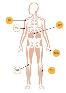 Managing Manual Handling Risks — Safety Action