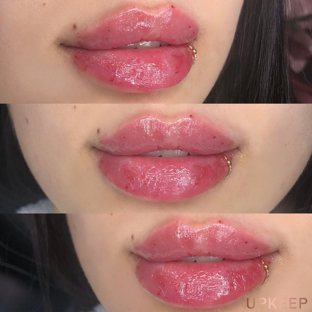 UPKEEP MED SPA — Injections, Aesthetics, Laser and Body Contouring in ... UPKEEP MED SPA — Injections, Aesthetics, Laser and Body Contouring in ...
