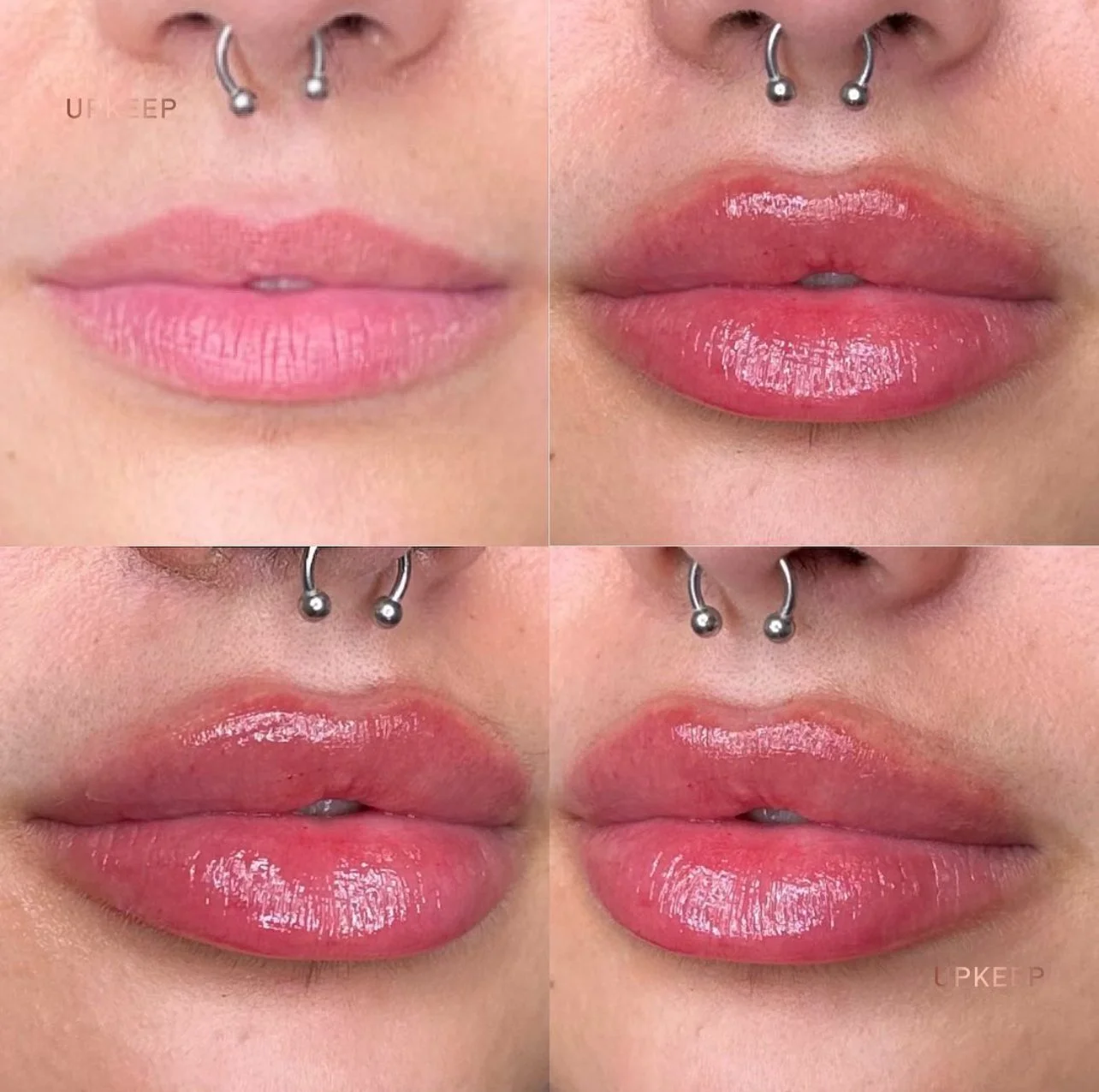 UPKEEP MED SPA — Injections, Aesthetics, Laser and Body Contouring in ... UPKEEP MED SPA — Injections, Aesthetics, Laser and Body Contouring in ...