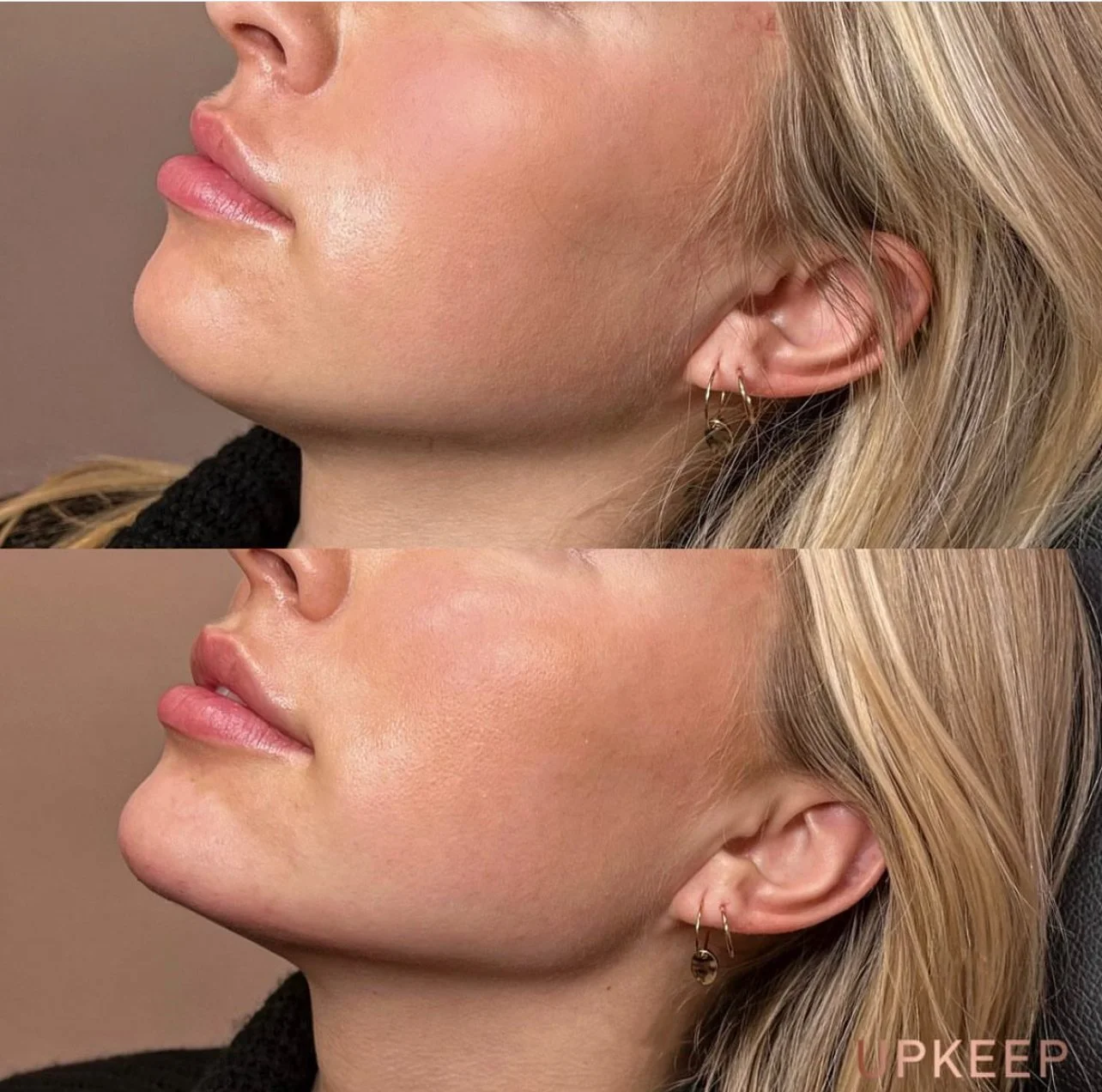UPKEEP MED SPA — Injections, Aesthetics, Laser and Body Contouring in ... UPKEEP MED SPA — Injections, Aesthetics, Laser and Body Contouring in ...