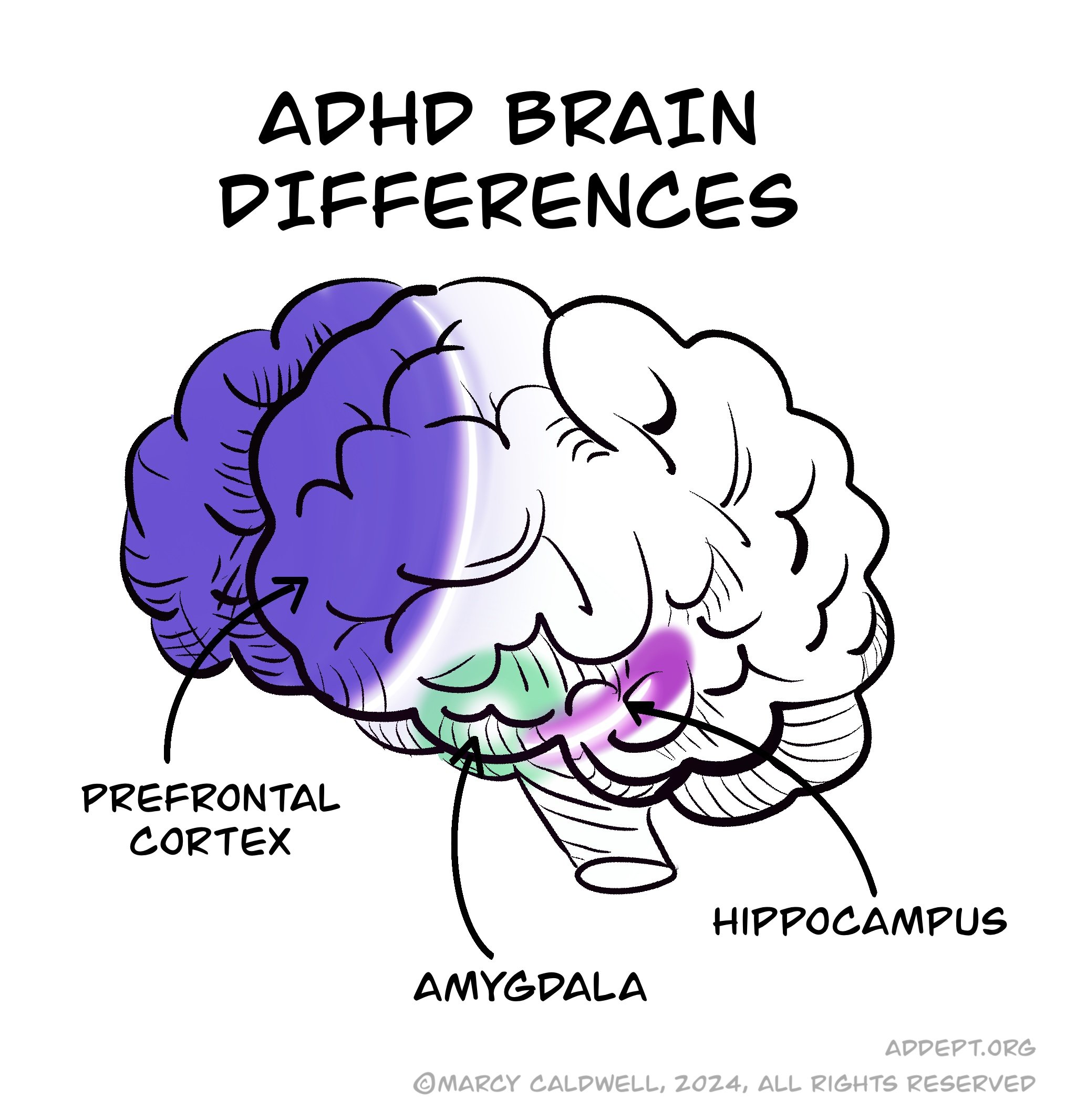 Review of Brain FM for ADHD — ADDept