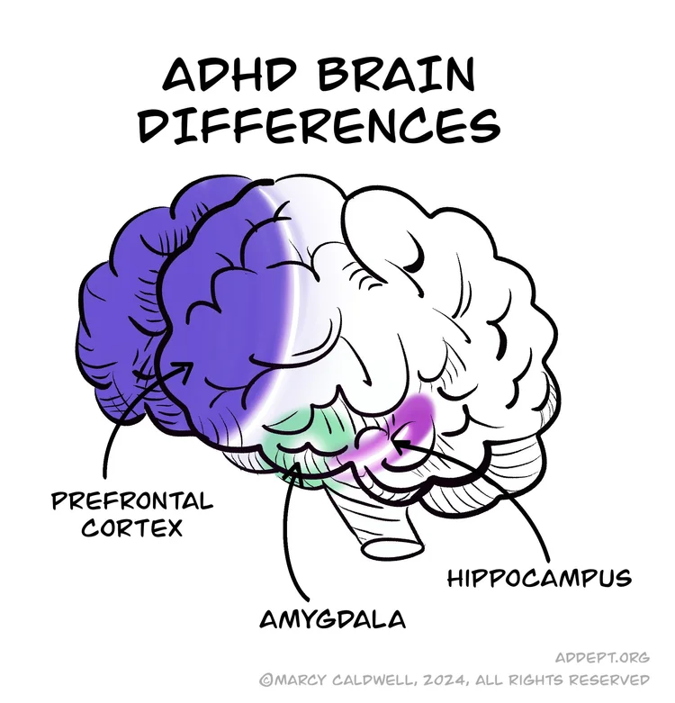 Review of Brain FM for ADHD — ADDept