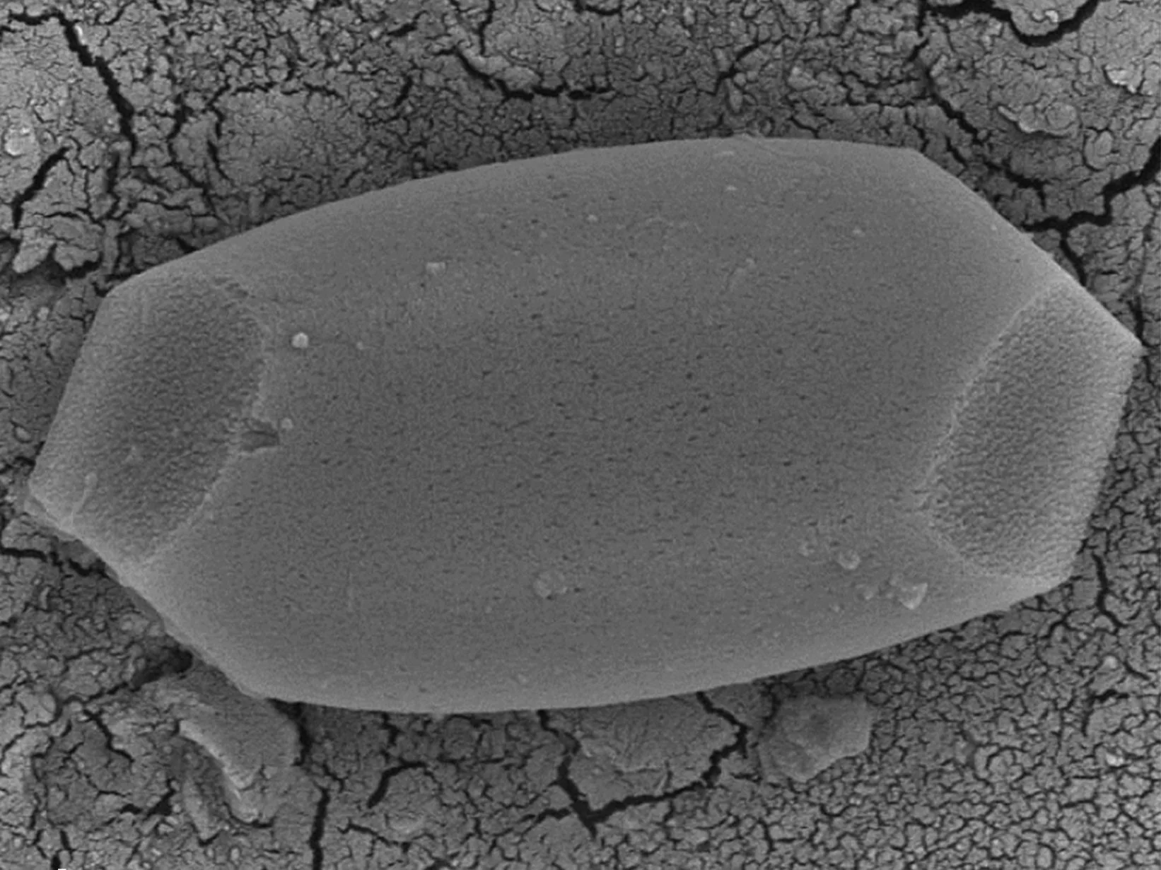 Vestibular Health — What are the otoliths?