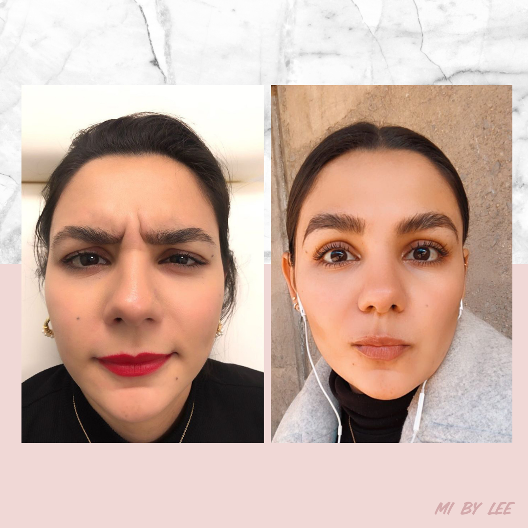 Mi by Lee — Before & After gallery