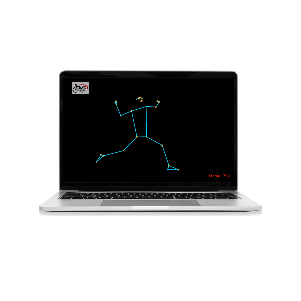 DVS X-Ray - Innovative Markerless Motion Capture — DVS BASEBALL