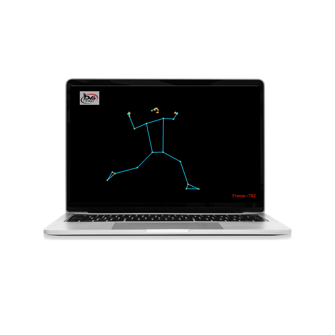 Dvs X Ray Innovative Markerless Motion Capture Dvs Baseball