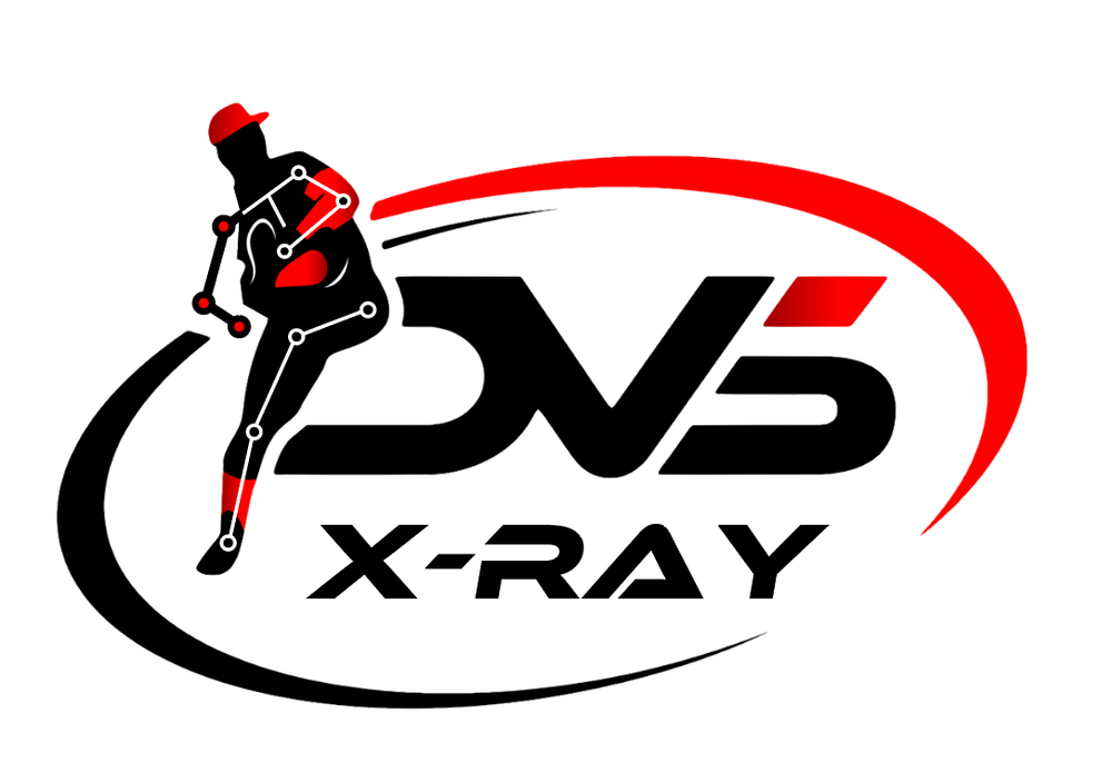 DVS X-Ray - Innovative Markerless Motion Capture — DVS BASEBALL