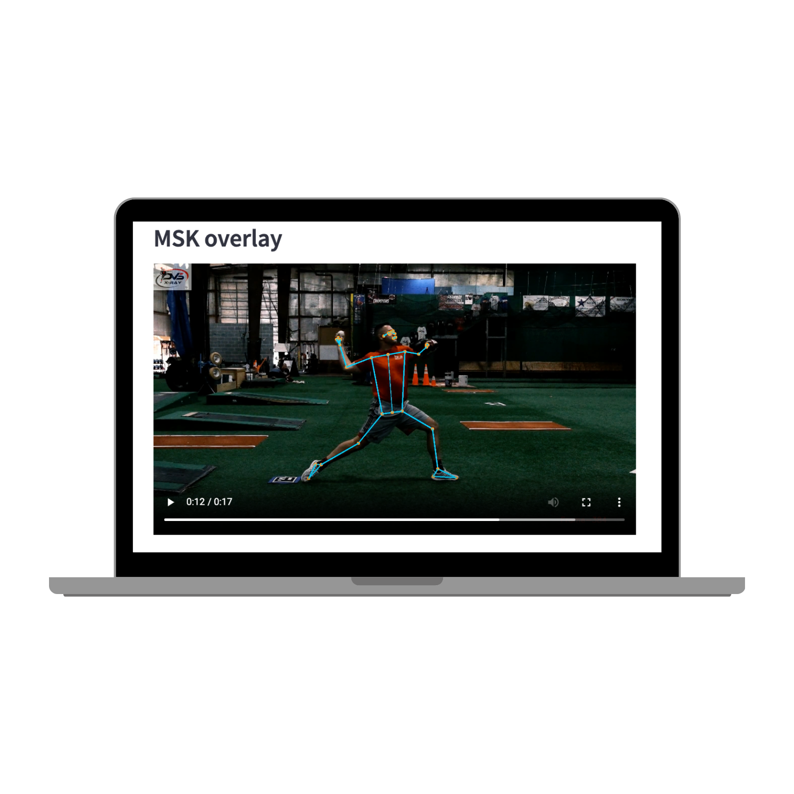 DVS X-Ray - Innovative Markerless Motion Capture — DVS BASEBALL