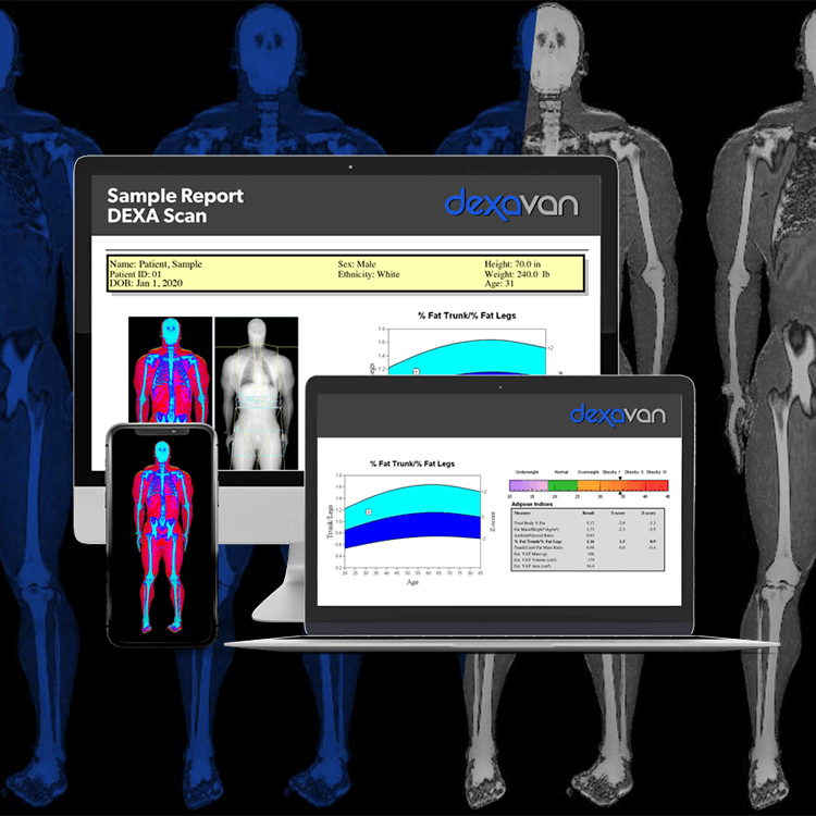 DexaVan | Mobile DEXA | Body Composition Scans Vancouver, WA & Portland, OR