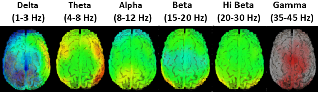 An Examination of the Roxiva Stroboscopic Lamp on Quantitative EEG ...