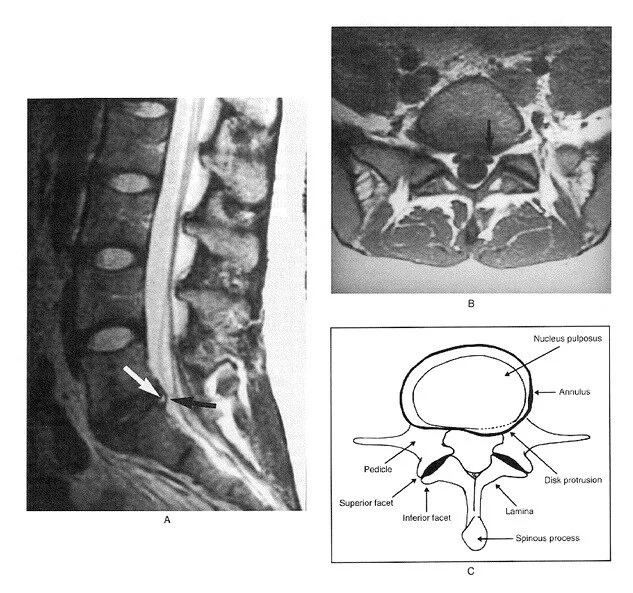MRI - What is Normal ? — Knotry
