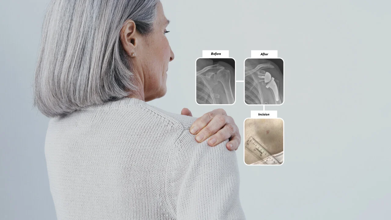 Los Angeles Orthopedics | Han Orthopaedics