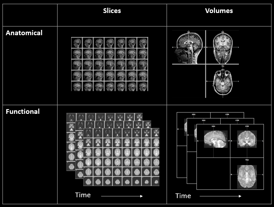 Tutorial 1: Data — NEWBI 4 fMRI