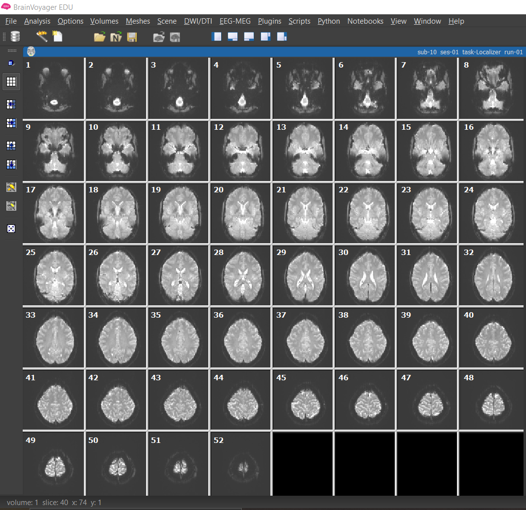 Tutorial 1: Data — NEWBI 4 fMRI