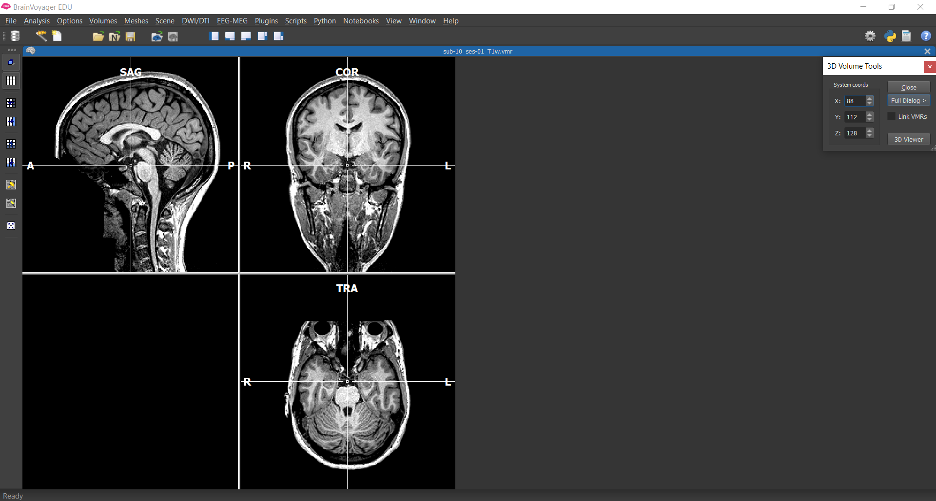 Tutorial 1: Data — NEWBI 4 fMRI