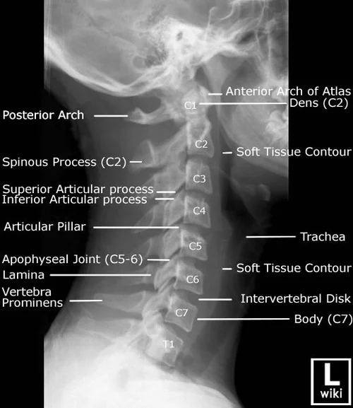 Cervical Spine Anatomy — Connect Physical Therapy
