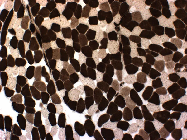 Fiber-type Profiles of the Locomotor Muscles of Arctic Seals — Skeletal ...