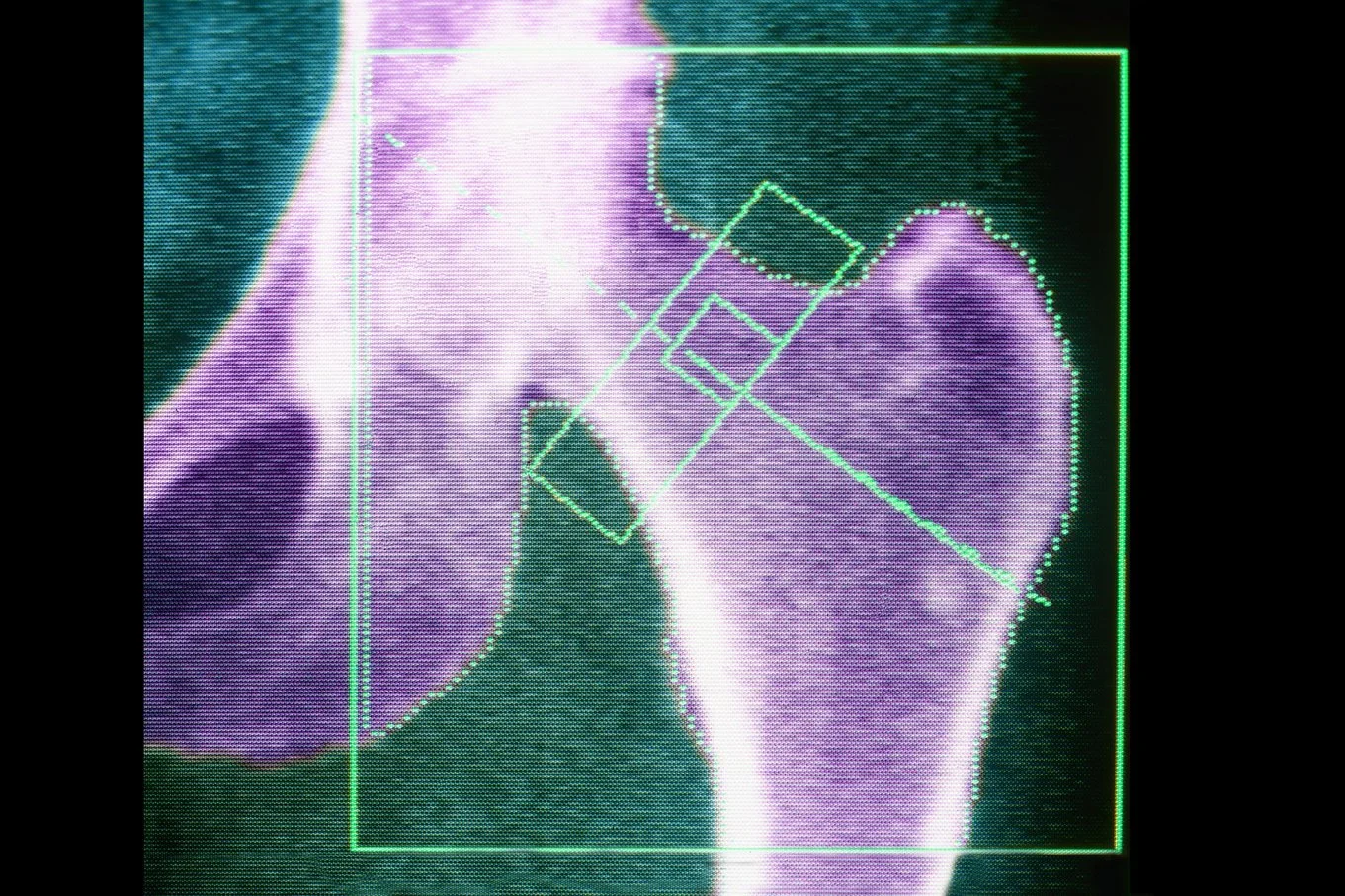 What to Do Now, So Your Bones Won't Be Frail Later — Gloria