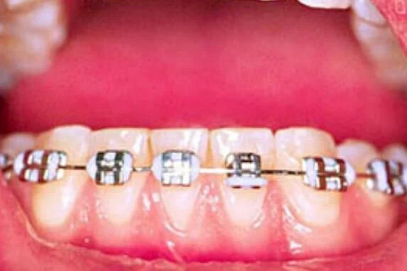 General 2 — Edgecliff Orthodontics