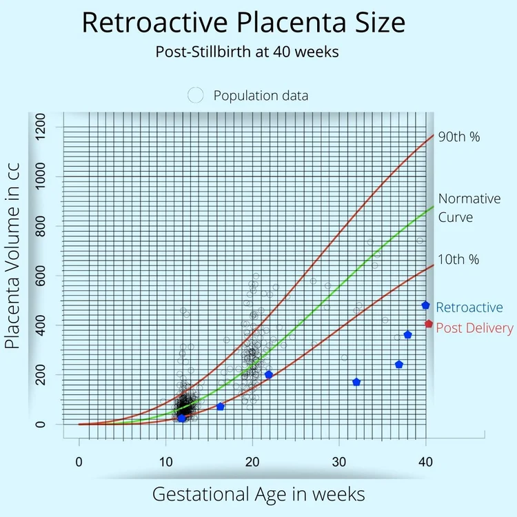 Measure the Placenta - Measure. Track. Prevent.