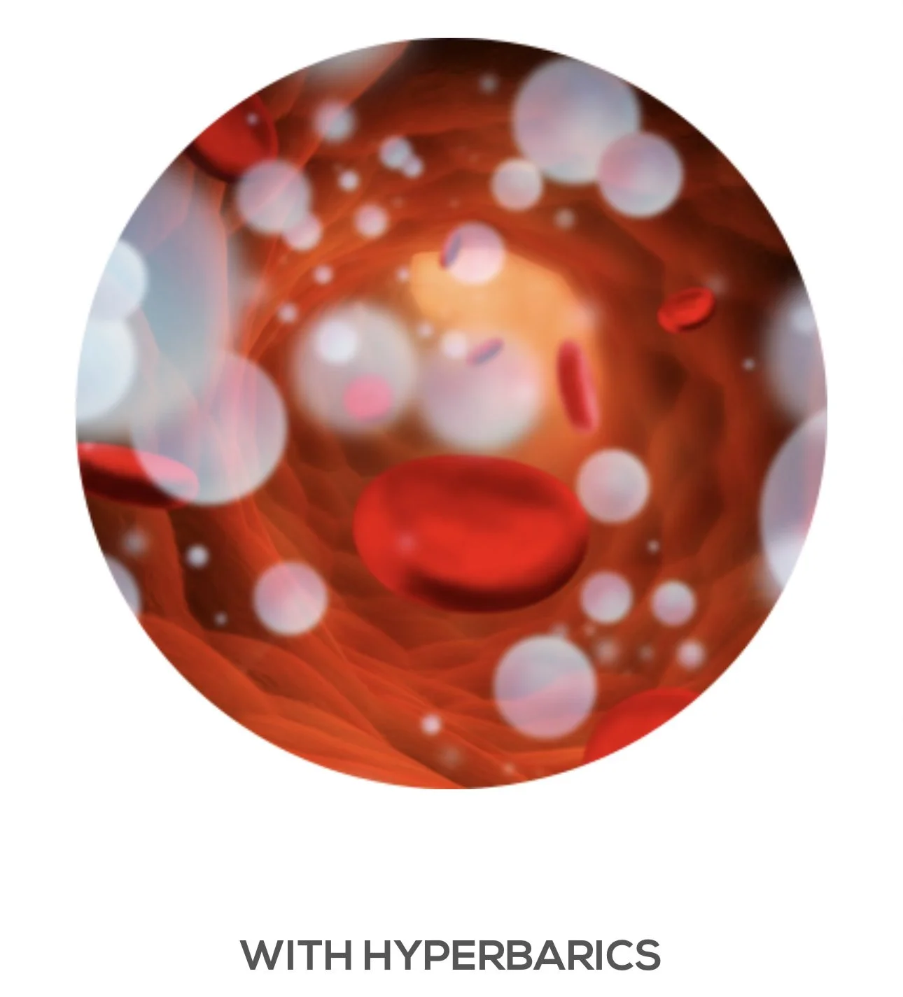 Hyperbaric Oxygen Therapy — Elevate Performance