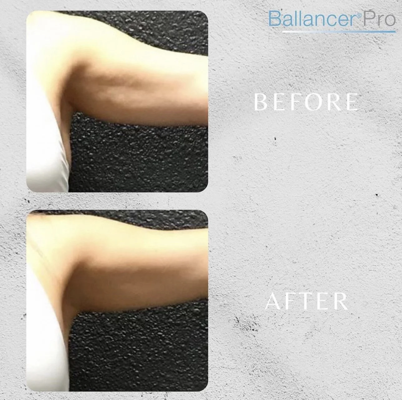 Ballancer Pro — Elevate Performance