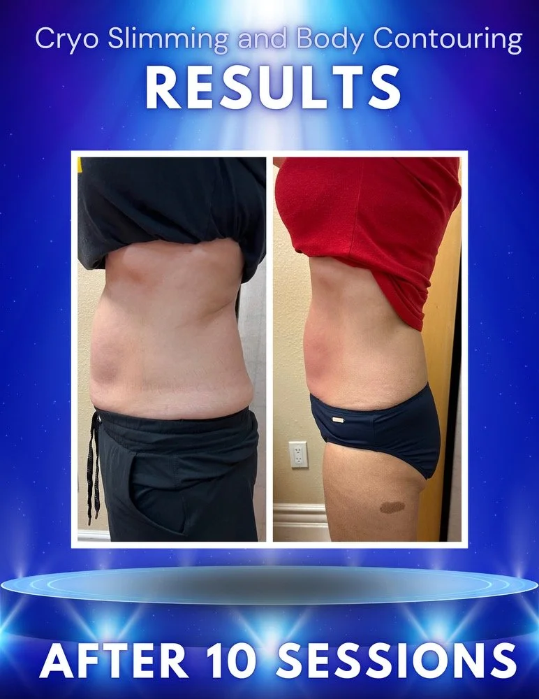 Cryo Slimming — Elevate Performance