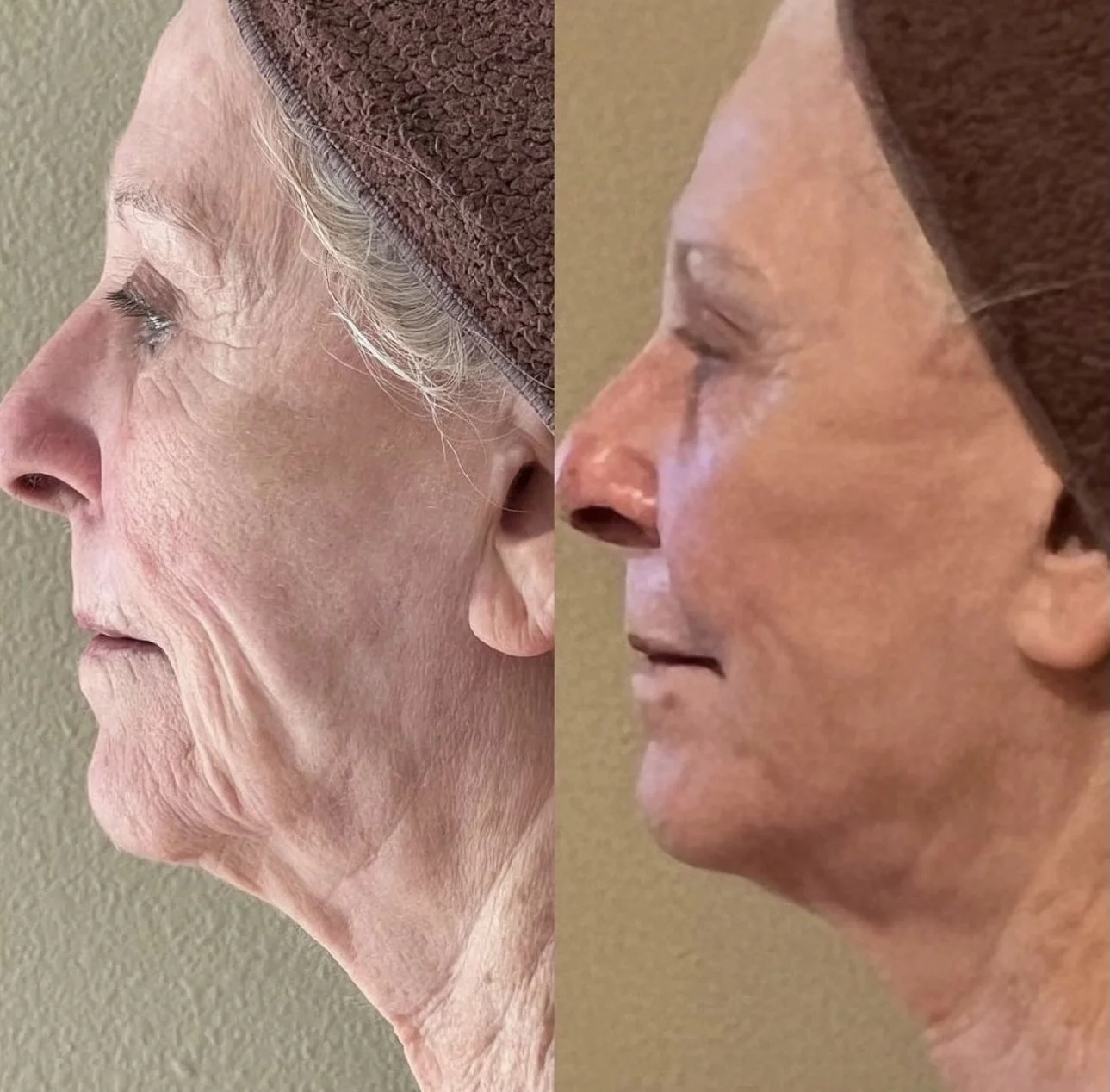 Jet Plasma Pro — Elevate Performance