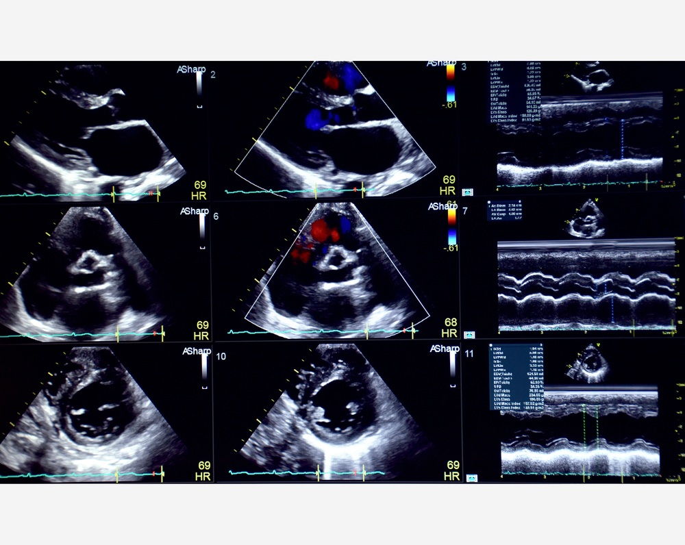 Premier Life Scans - Preventative Health Screening