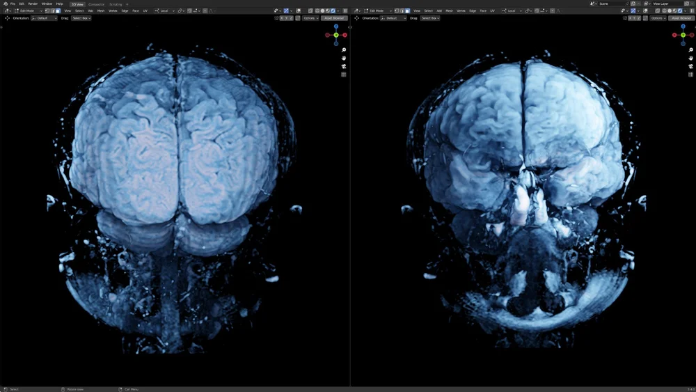 MRI Visualizations in Blender — Curtis Holt