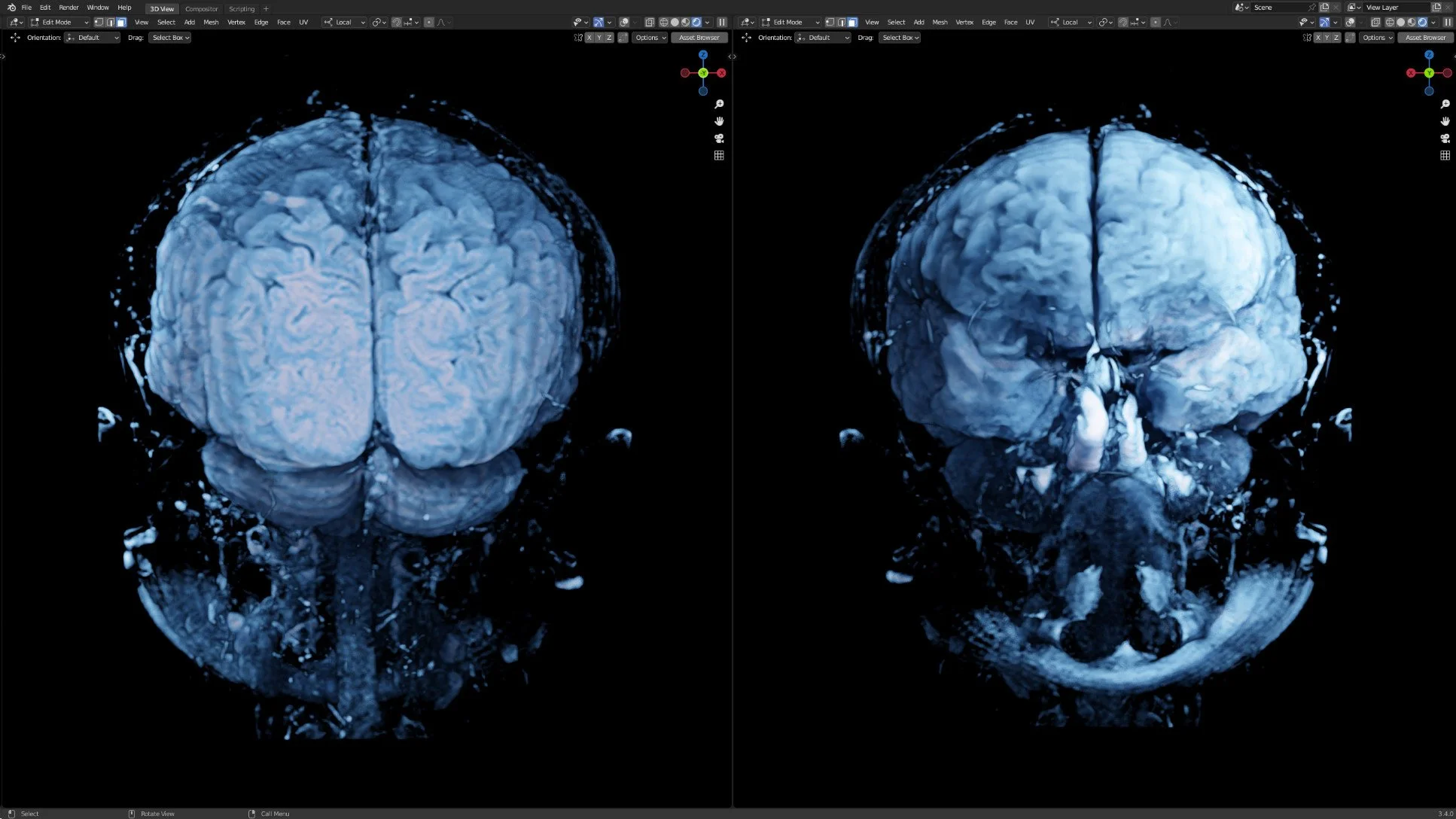 MRI Visualizations in Blender — Curtis Holt