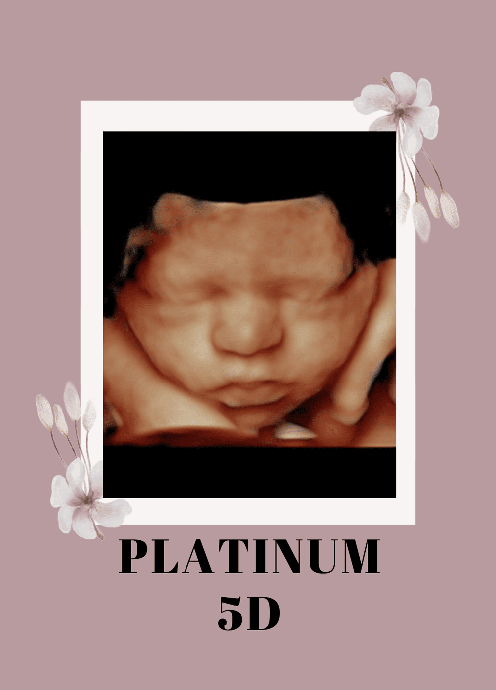 Services 2 — Baby Pix
