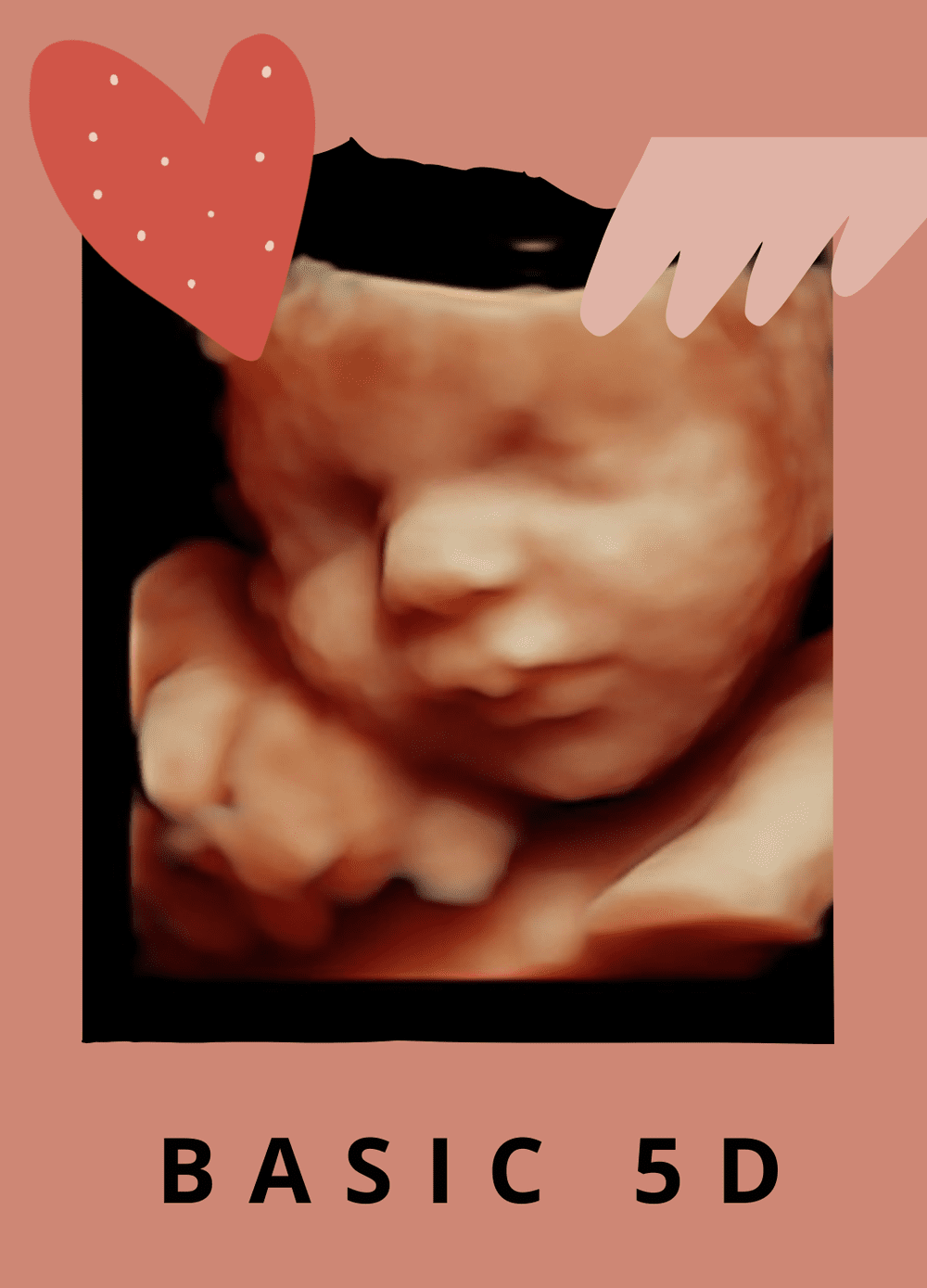 Services 2 — Baby Pix
