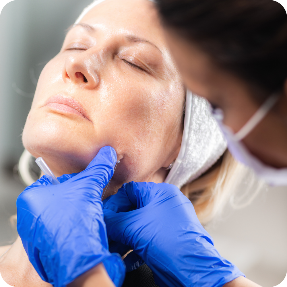 THREADS | Enhance Your Appearance Today – Book Now — Lawson Aesthetics ...