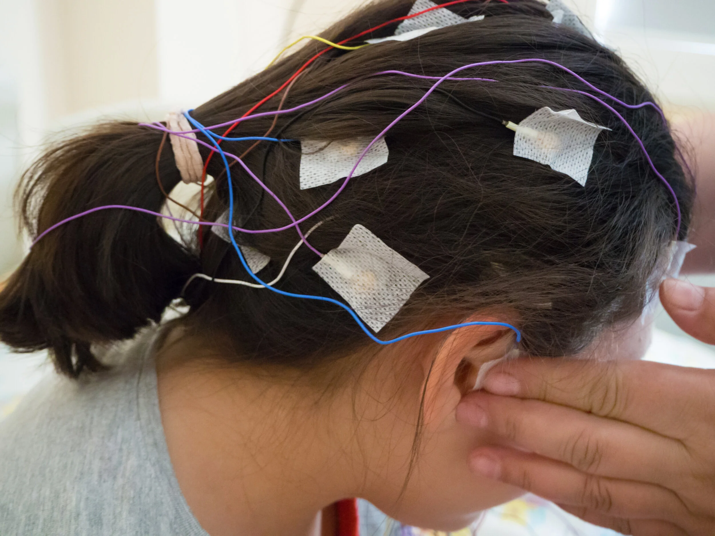 The types of brain scan - epilepsy - neurology - Epilepsy Sparks ...