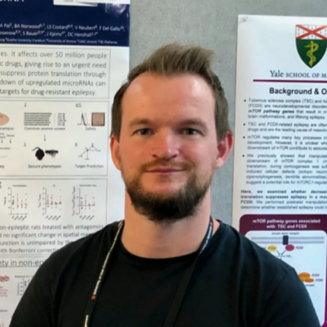 Putting Epilepsy in English! — Epilepsy Sparks