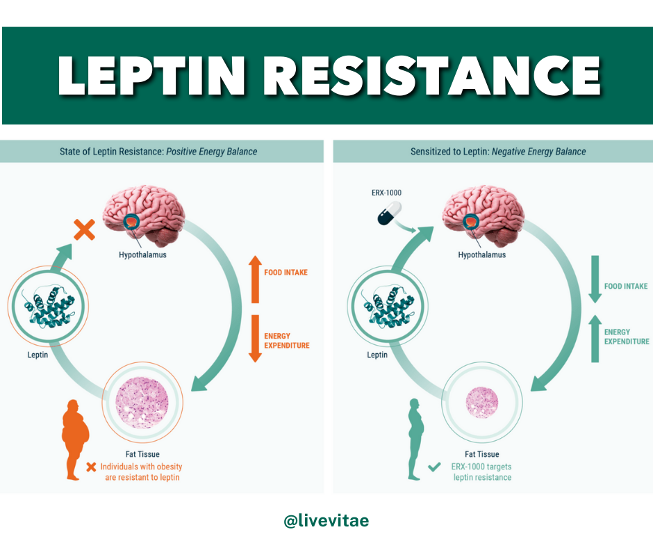 How Artificial Light Makes Us Fat - Live Vitae