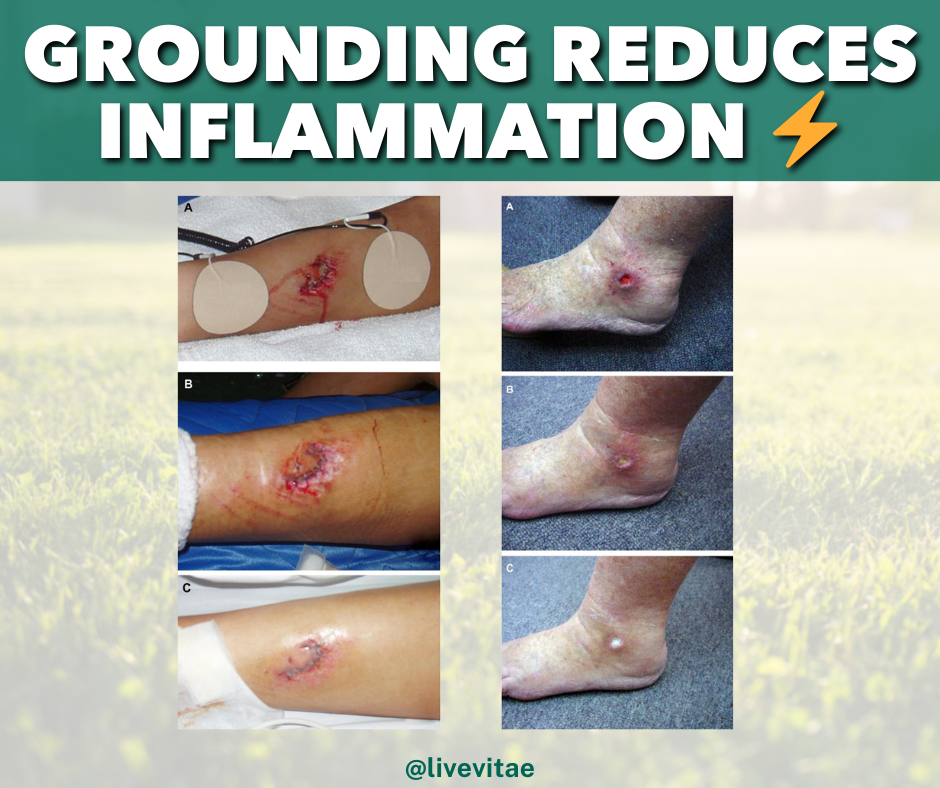 Grounding Benefits: How Can It Improve Your Health? - Live Vitae
