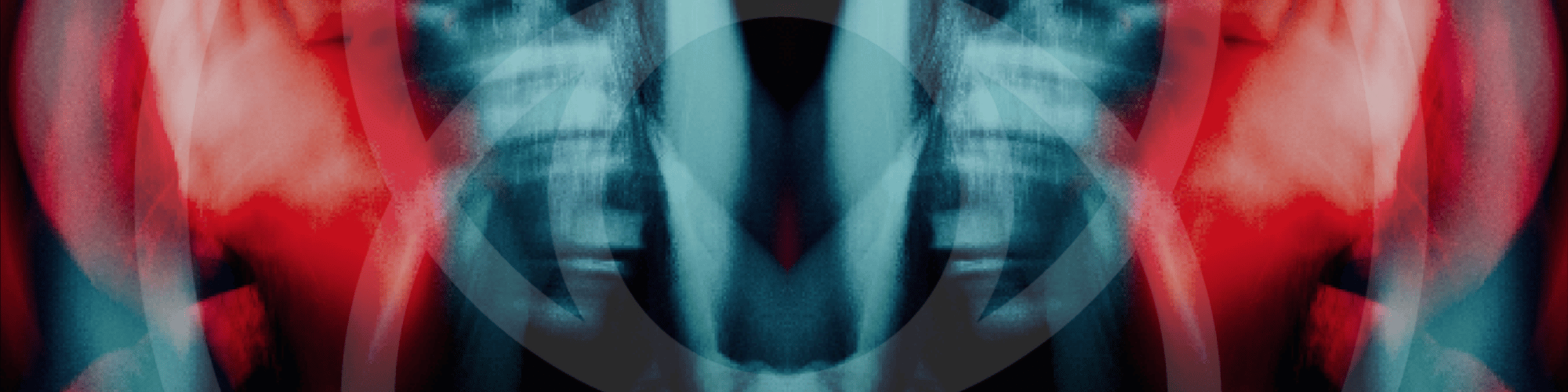 HPPD - Hallucinogen Persisting Perception Disorder — The Psychedelic ...